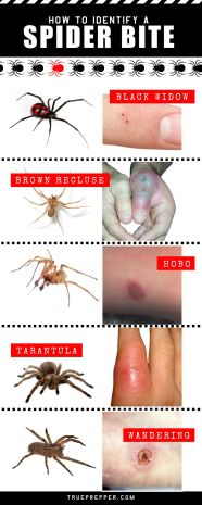 Spider Bite Identification Chart FYNSR Spider Bite Identification Chart FYNSR