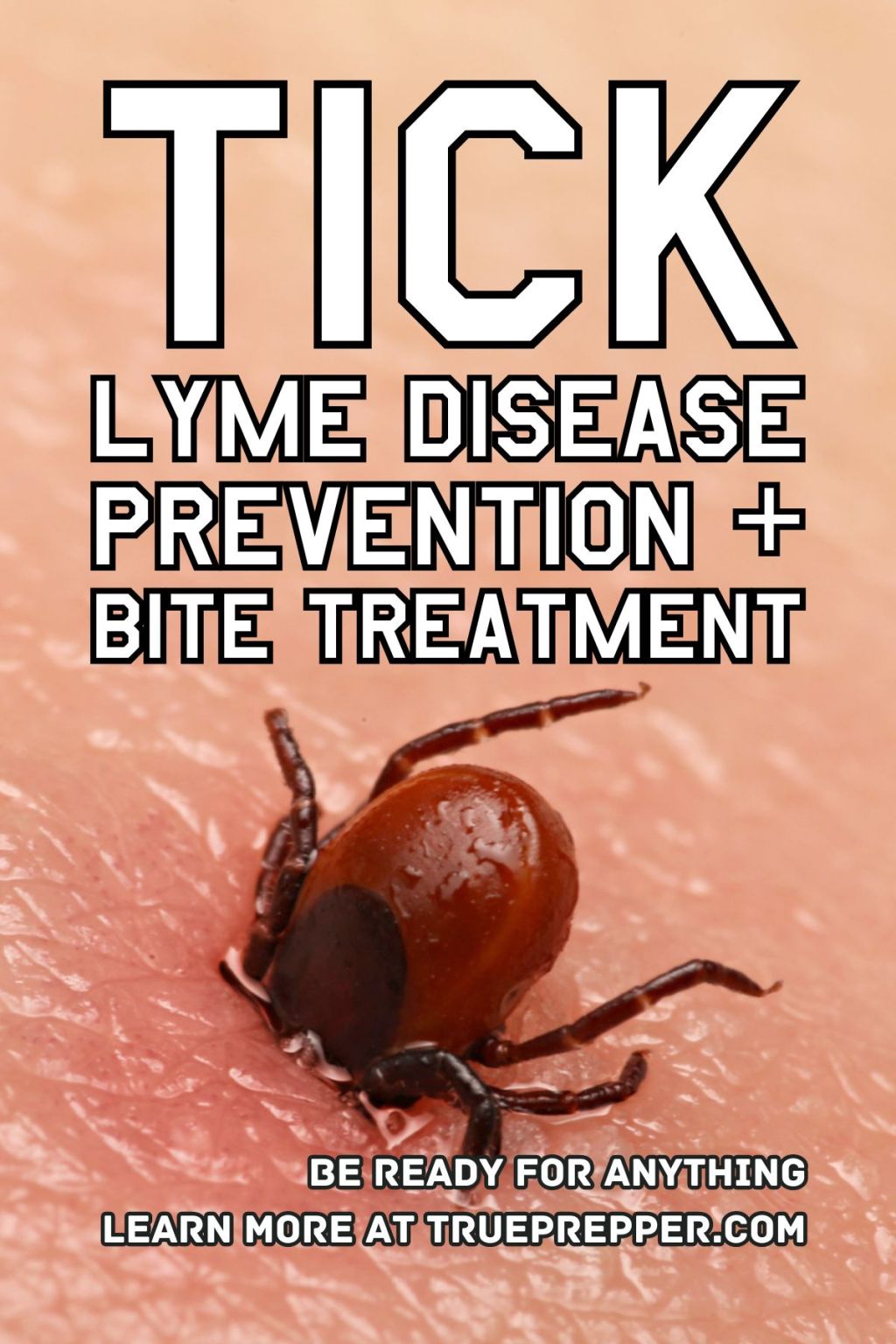 Tick Lyme Disease Prevention and Bite Treatment | TruePrepper